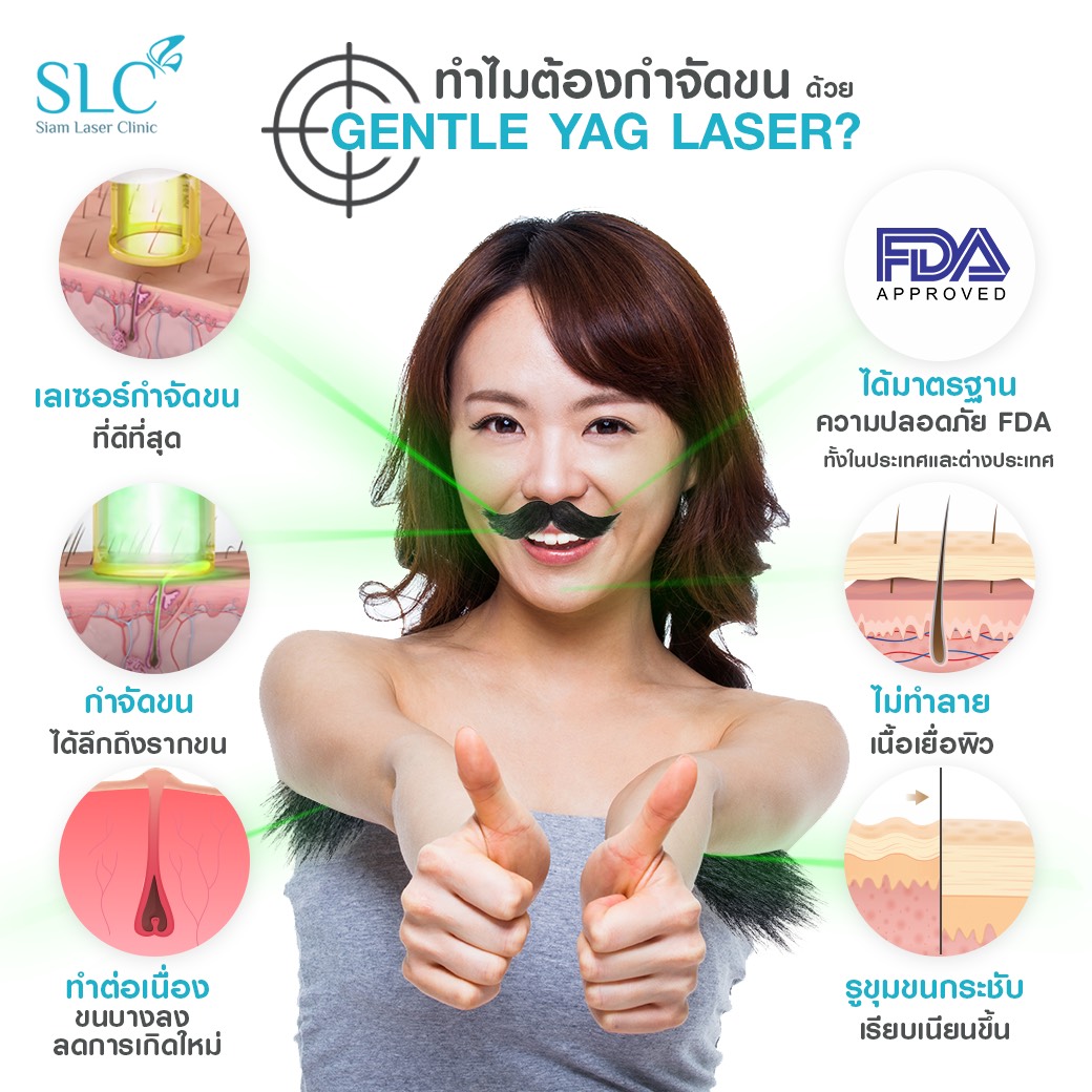 10 คำถาม ก่อนเลเซอร์ขนรักแร้ต้องรู้ Articles Slcclinicsandhospital